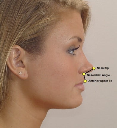 types of rhinoplasty - types of cosmetic nose surgery